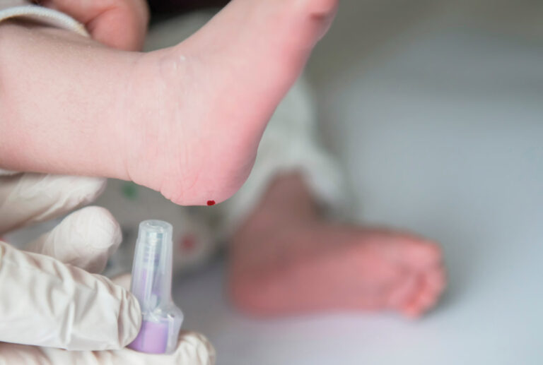 Home | MLD Support Association UK